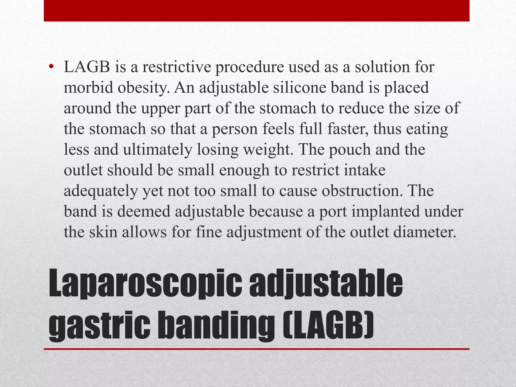 Gastric by pass | PPTX
