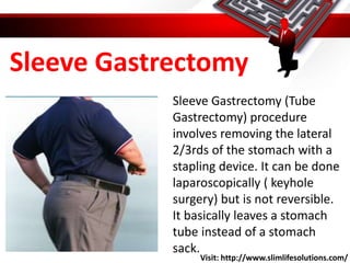 Gastric bypass part i | PPT