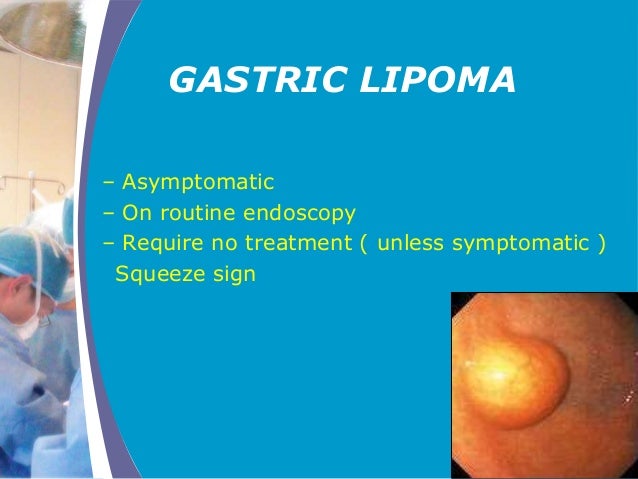 Gastric Cancer