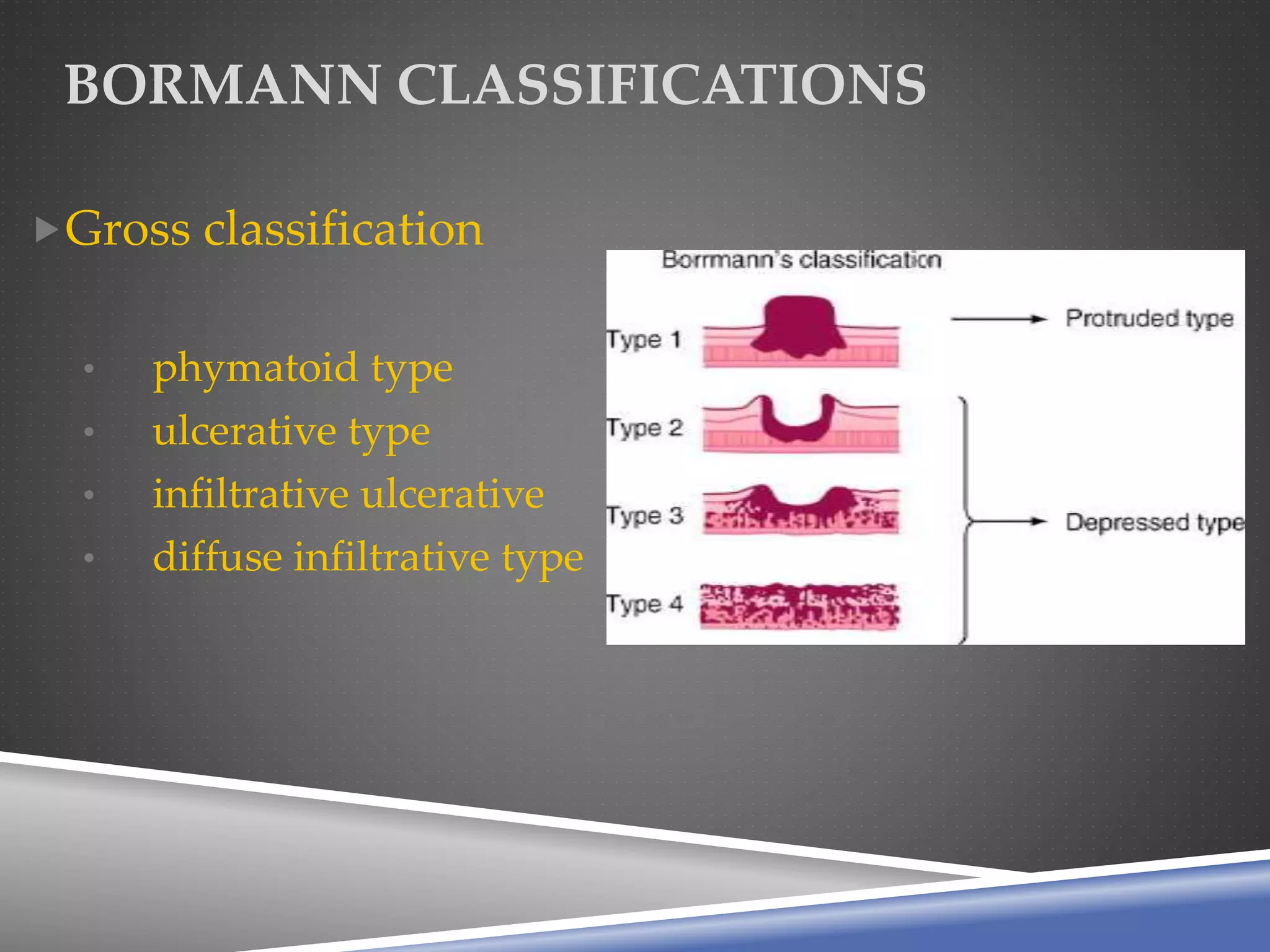 Gastric Cancer ( stomach tumor ) | PPTX