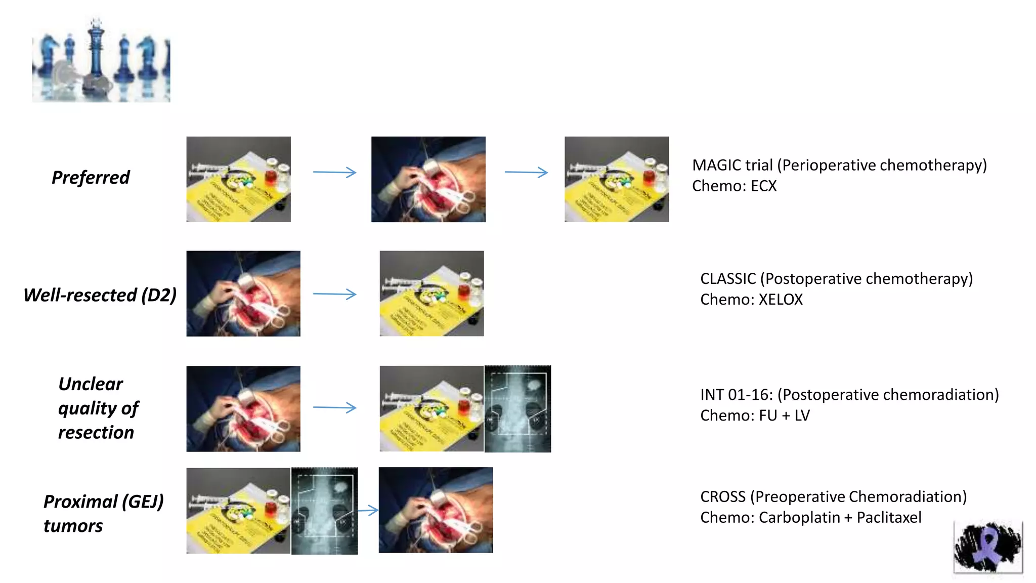 CES2016-02: Gastric cancer | PPTX