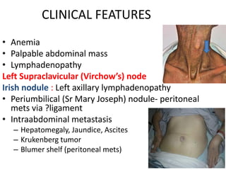 Gastric carcinoma | PDF