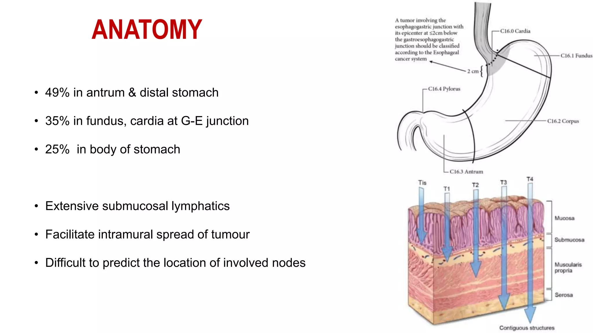 Gastric Cancer Evidence Based Management | PPTX
