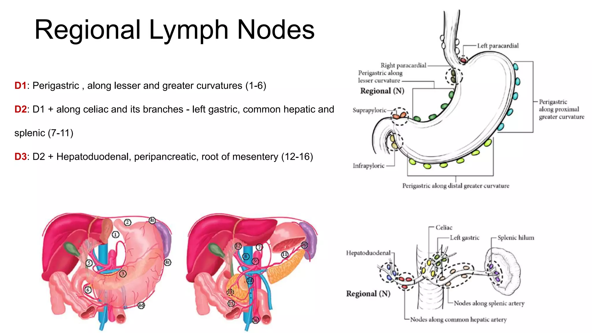 Gastric Cancer Evidence Based Management | PPTX
