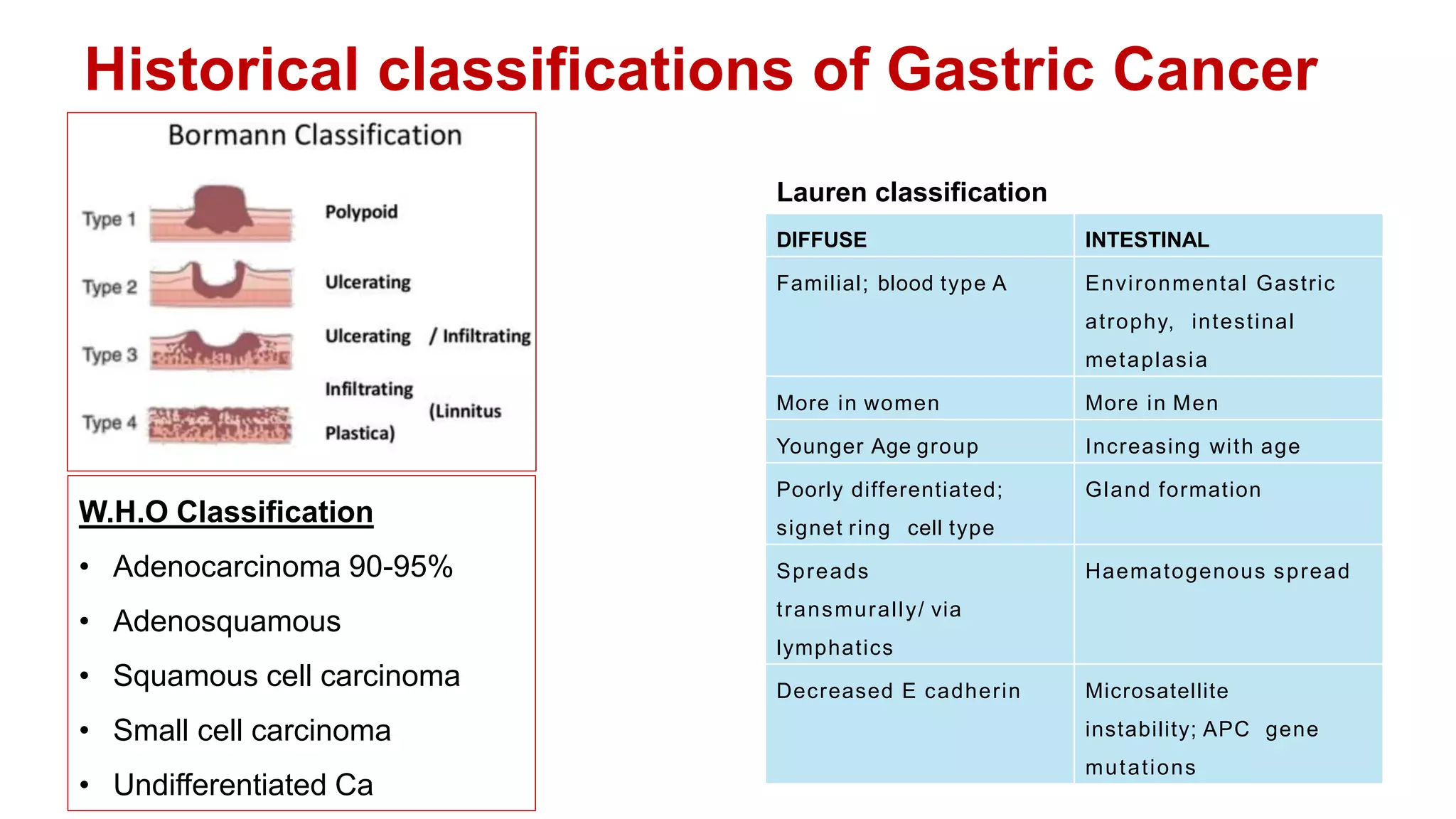 Gastric Cancer Evidence Based Management | PPTX