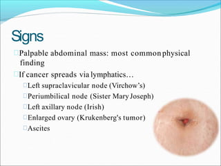 gastric cancer.pptx
