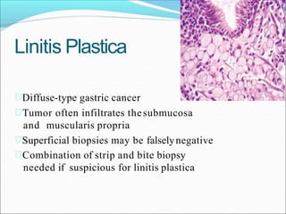 gastric cancer.pptx