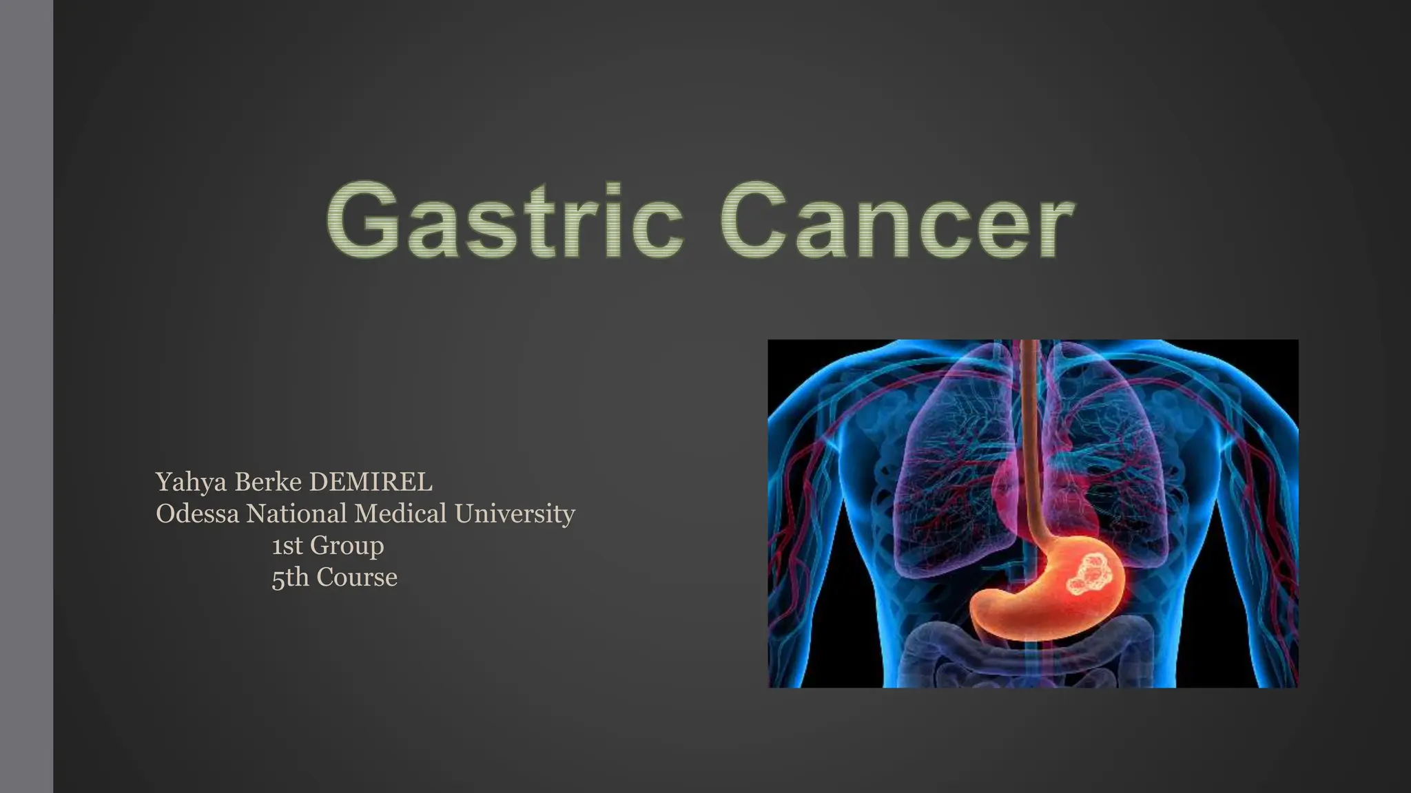 Gastric cancer | PPT