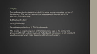 Gastric cancer | PPSX