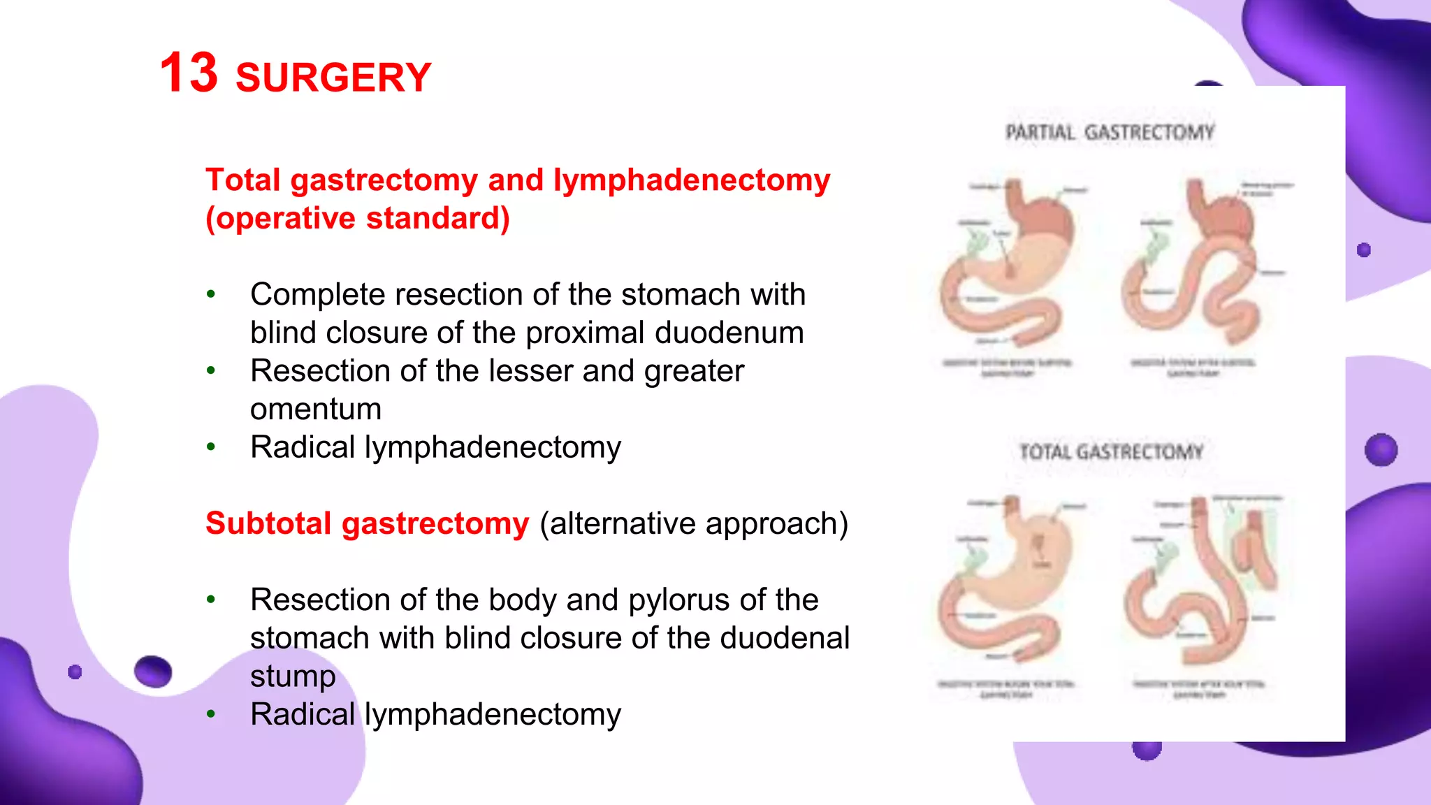 Gastric Cancer | PPTX