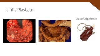 Gastric Cancer Final.pptx