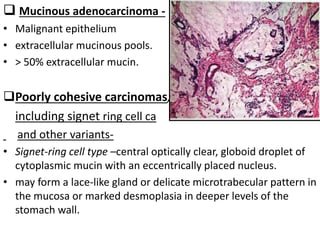 Gastric Cancer - Pathology Seminar | PPT