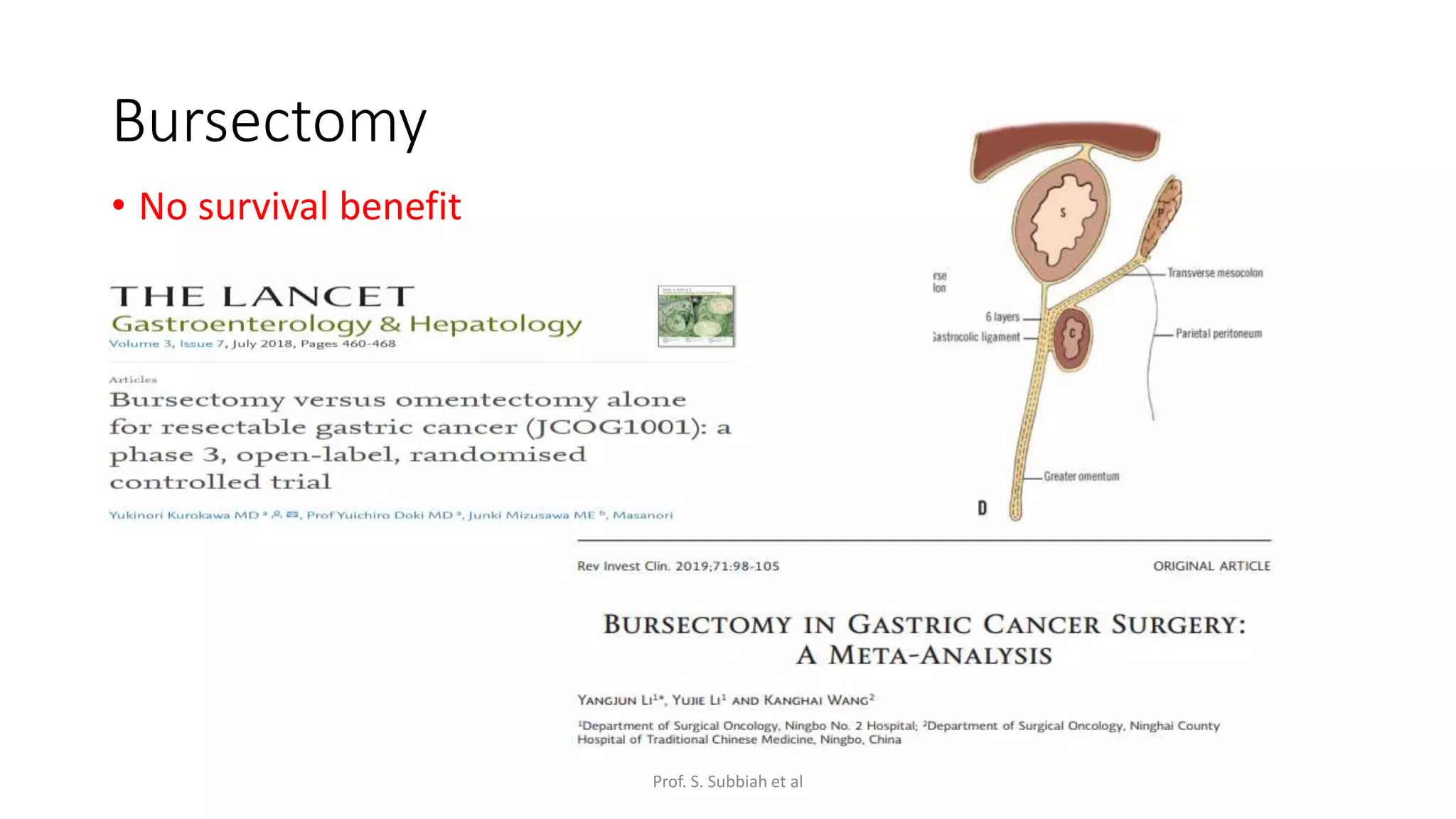 Gastric Cancer Surgery.pptx