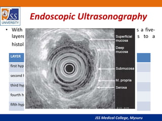 Gastric carcinoma radiology ppt | PPTX