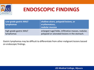 Gastric carcinoma radiology ppt | PPTX