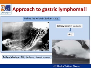Gastric carcinoma radiology ppt | PPTX