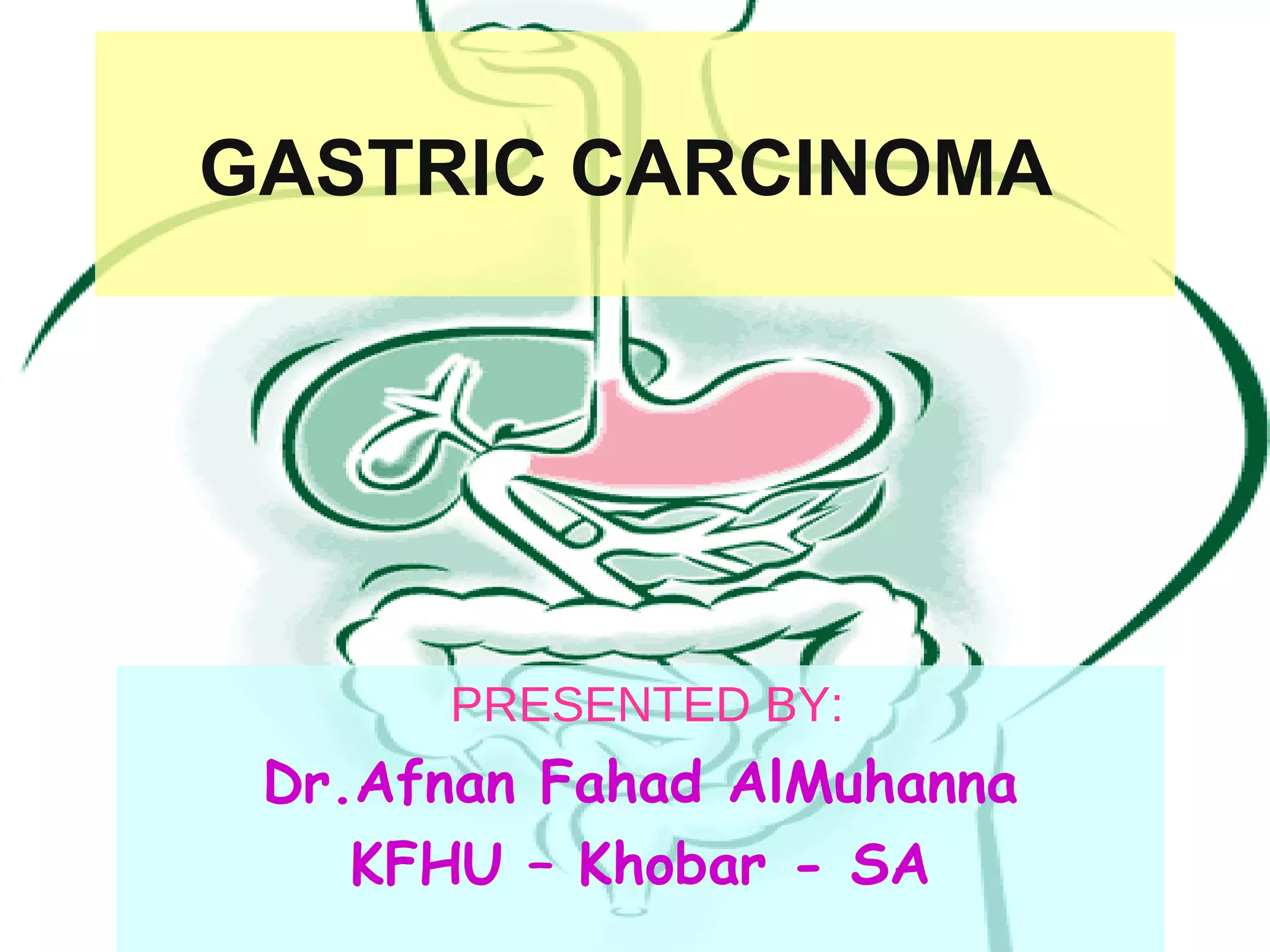 Gastric Carcinoma | PPT