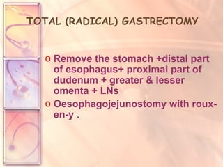 Gastric Carcinoma | PPT