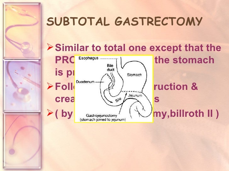 Total Gastrectomy Anatomy