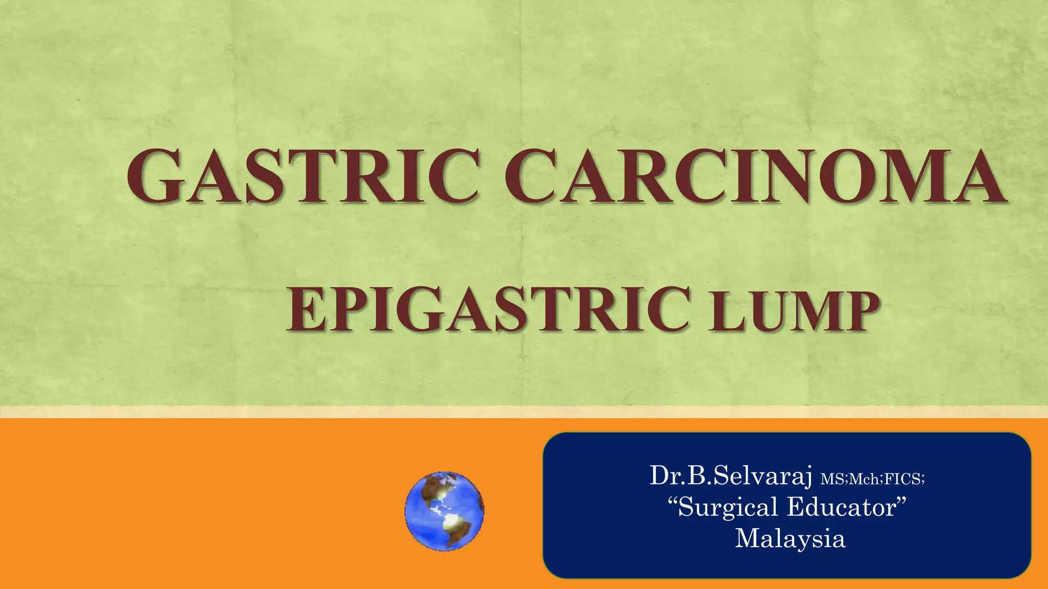 GASTRIC CARCINOMA- EPIGASTRIC LUMPS- Abdominal Lumps.pptx