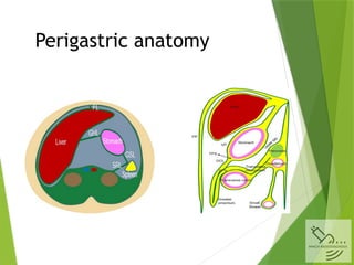 Radiological diagnosis of Gastric carcinoma | PPTX