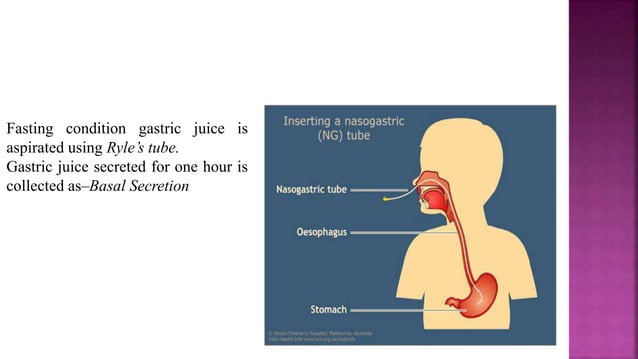 Gastric function test | PPTX | Digestive Disorders | Diseases and ...