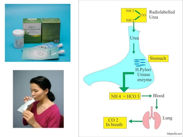 Gastric function test | PPT