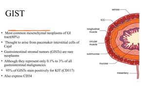 GASTRIC GIST(Gastrointestinal stromal tumors (GISTs) are typically ...
