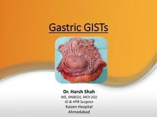 Gastric GIST by Dr Harsh Shah(www.gastroclinix.com) | PPT