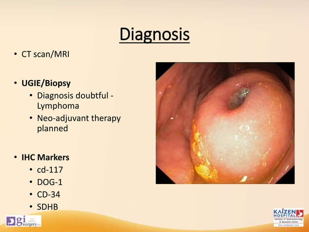 Gastric GIST by Dr Harsh Shah(www.gastroclinix.com) | PPT