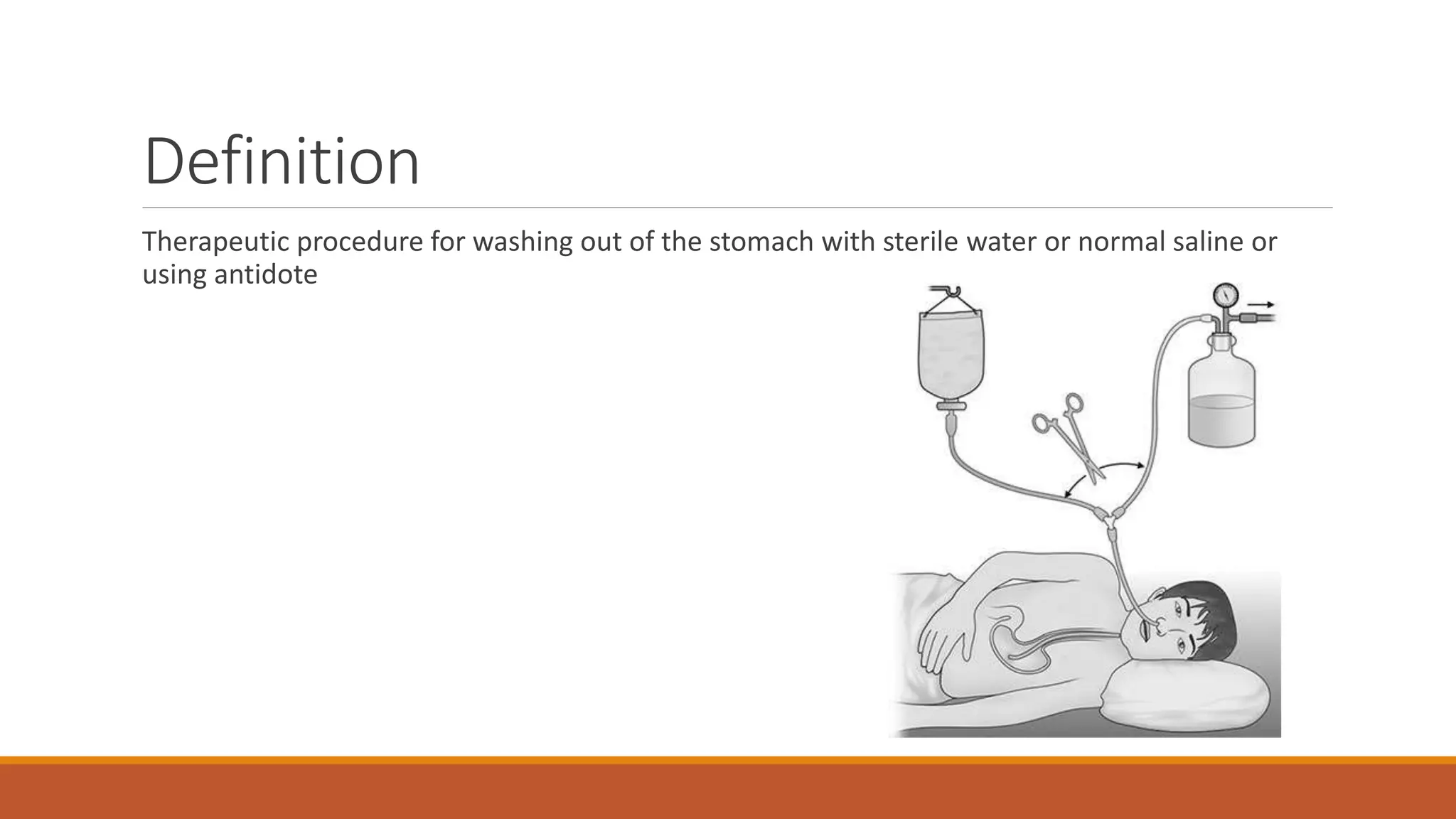 Gastric lavage | PPTX