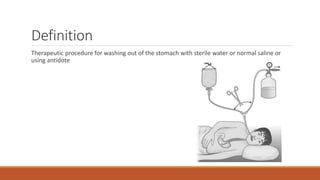 Gastric lavage | PPTX