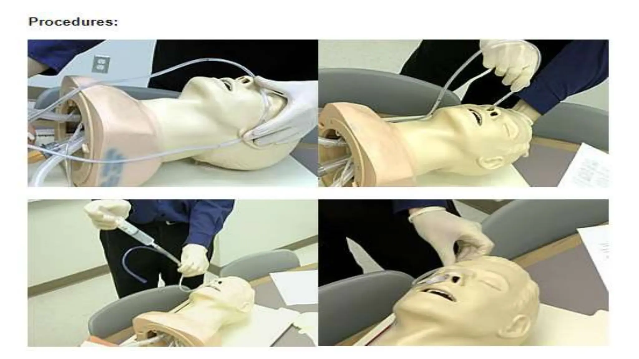 Gastric lavage. For medical students personal | PPTX