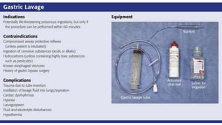 Gastric lavage. For medical students personal | PPTX
