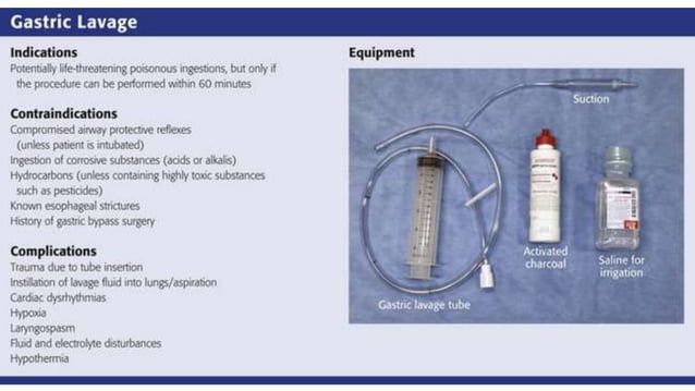 Gastric lavage. For medical students personal | PPTX