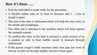 Gastric Lavage which is done in health care. | PPTX