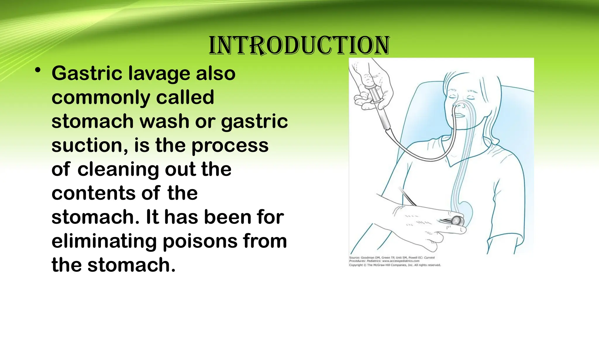 Gastric lavage. Performing and learning.pptx