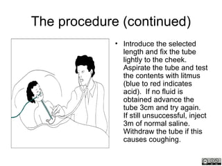 Gastric Lavage: Indications, Techniques, and Complications | PPT