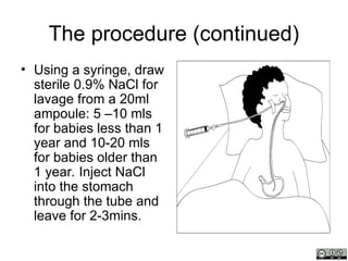 Gastric Lavage: Indications, Techniques, and Complications | PPT