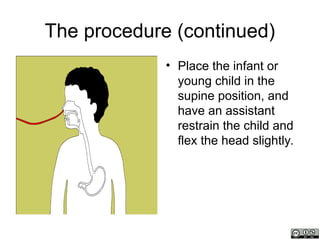 Gastric Lavage: Indications, Techniques, and Complications | PPT