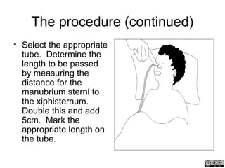 Gastric Lavage: Indications, Techniques, and Complications | PPT