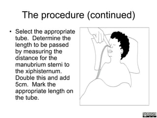Gastric_LavagePres.ppt