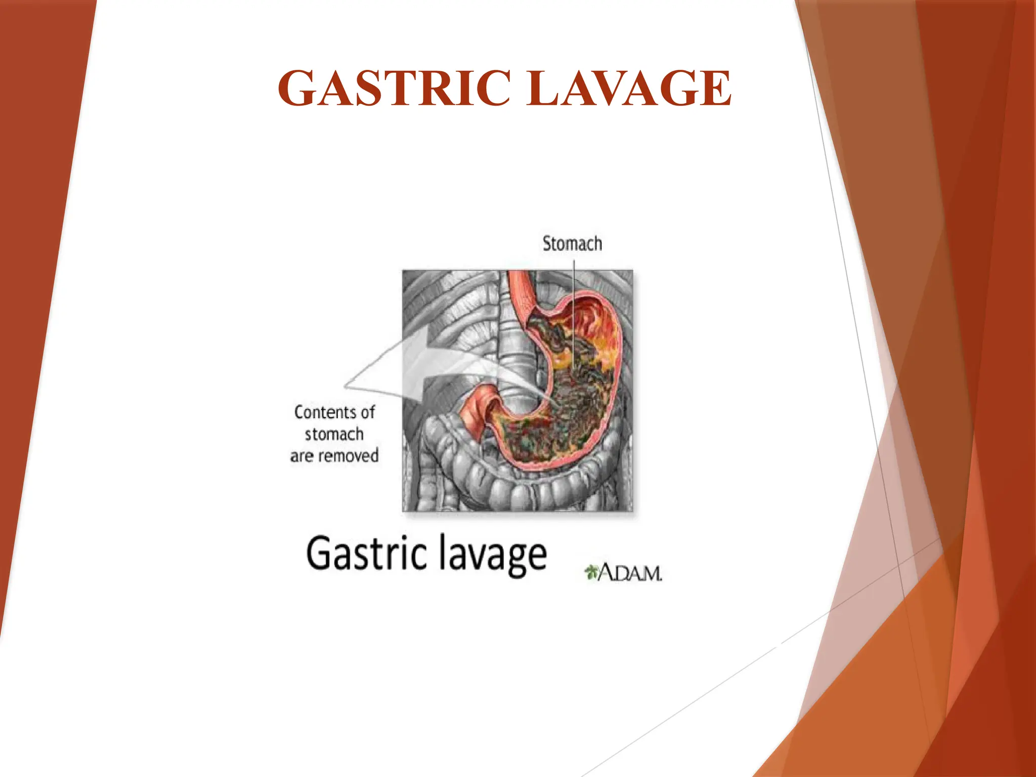Gastric_Lavage_Presentation in obstetrics and gynaecological nursing | PPTX