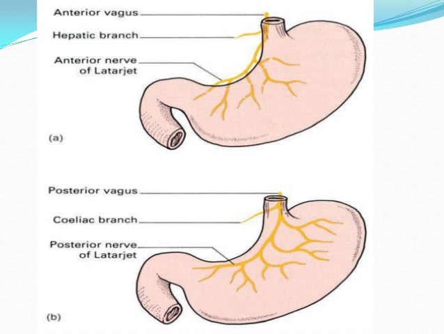 Gastric outlet obstruction