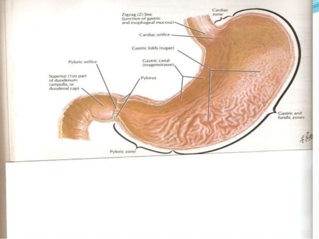 Gastric outlet obstruction