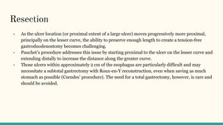 Gastric Perforation From Peptic Ulcer Disease - A Review of the ...