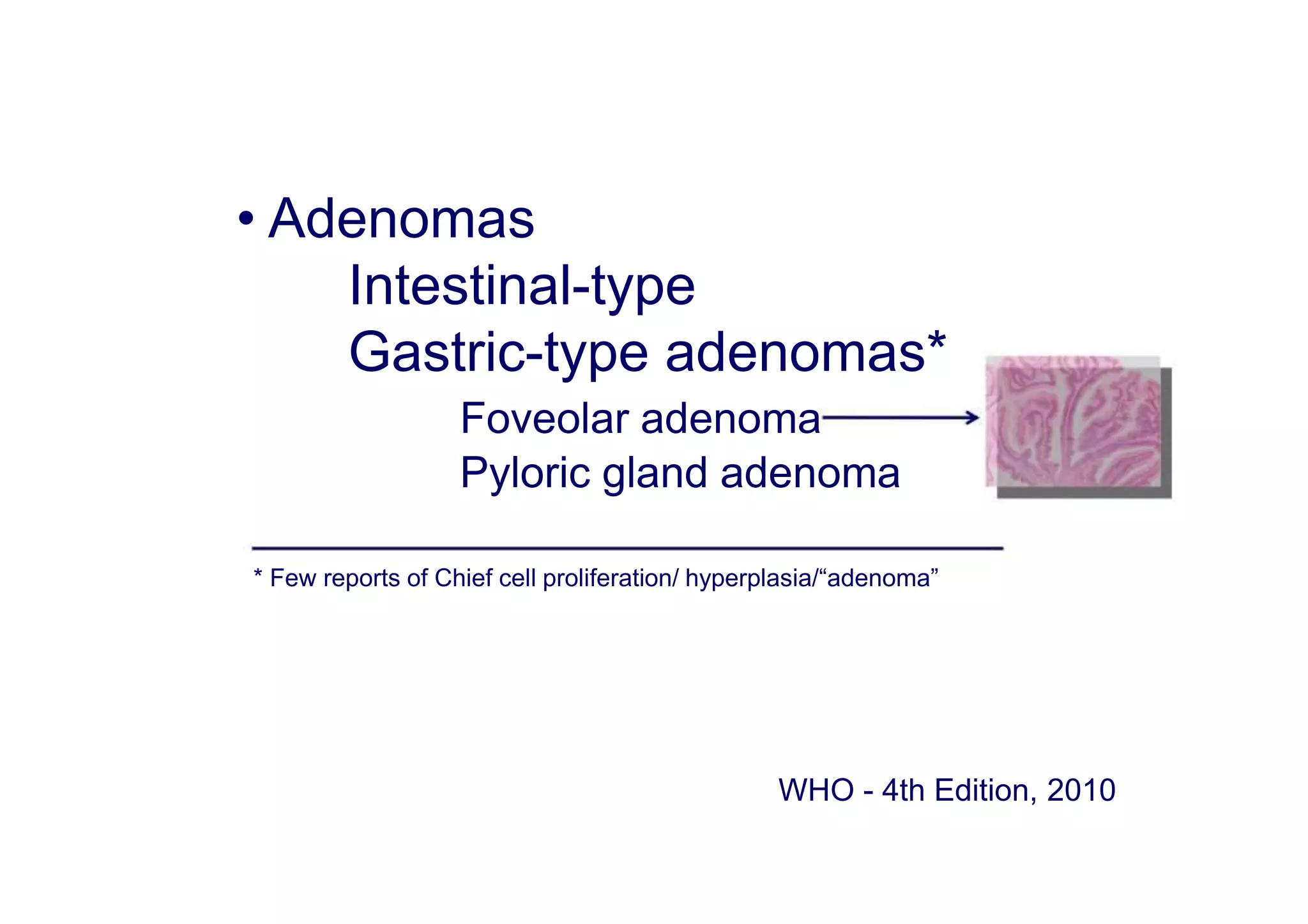 Gastric polyps | PPTX