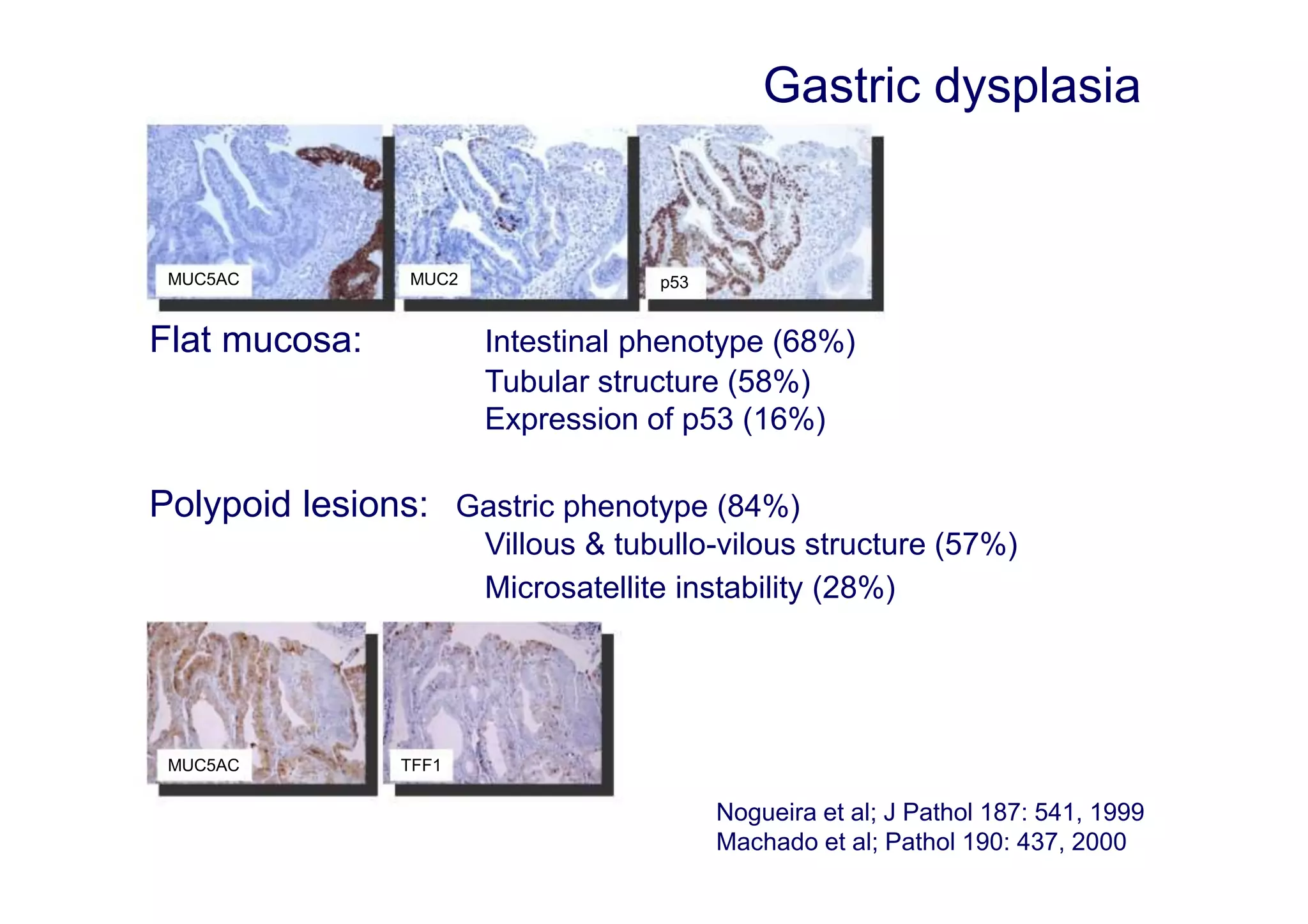 Gastric polyps | PPTX