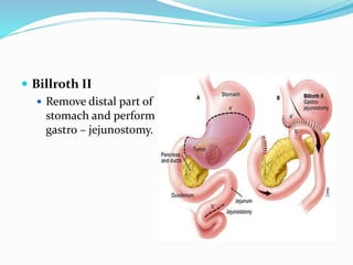 GASTRIC SURGERY AND ITS COMPLICATIONS.pptx