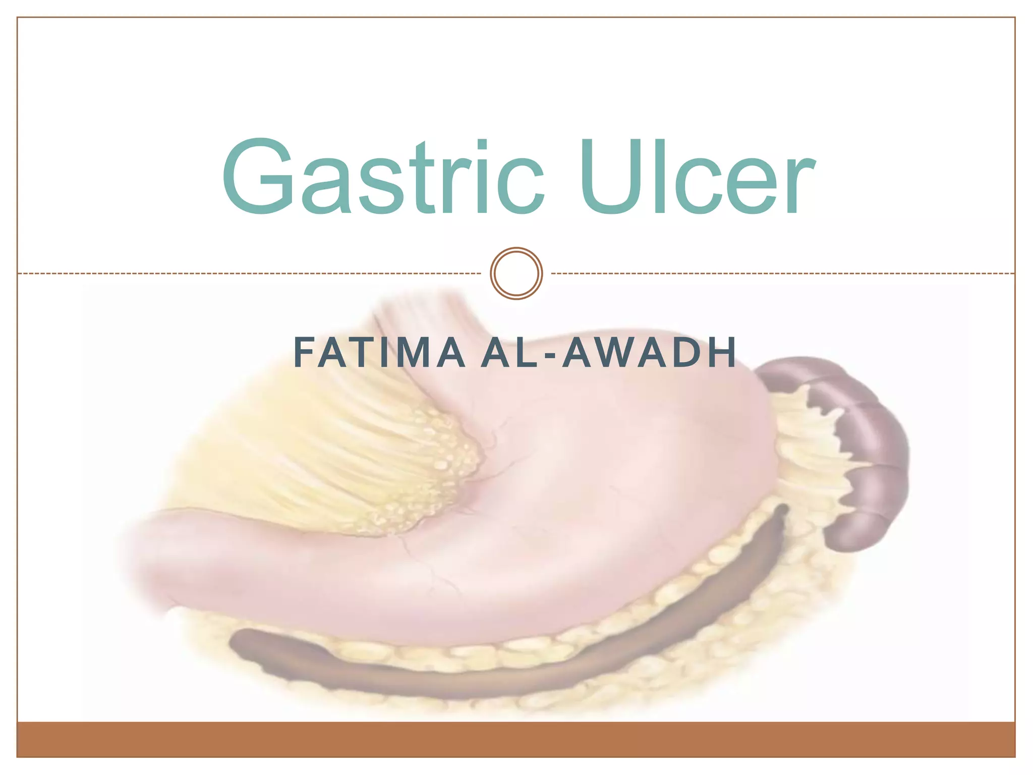 Gastric Ulcer | PPTX